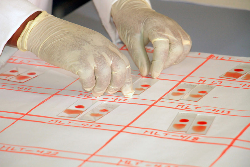 Harnessing Tech to Advance HIV Recency Testing - ICAP at Columbia ...